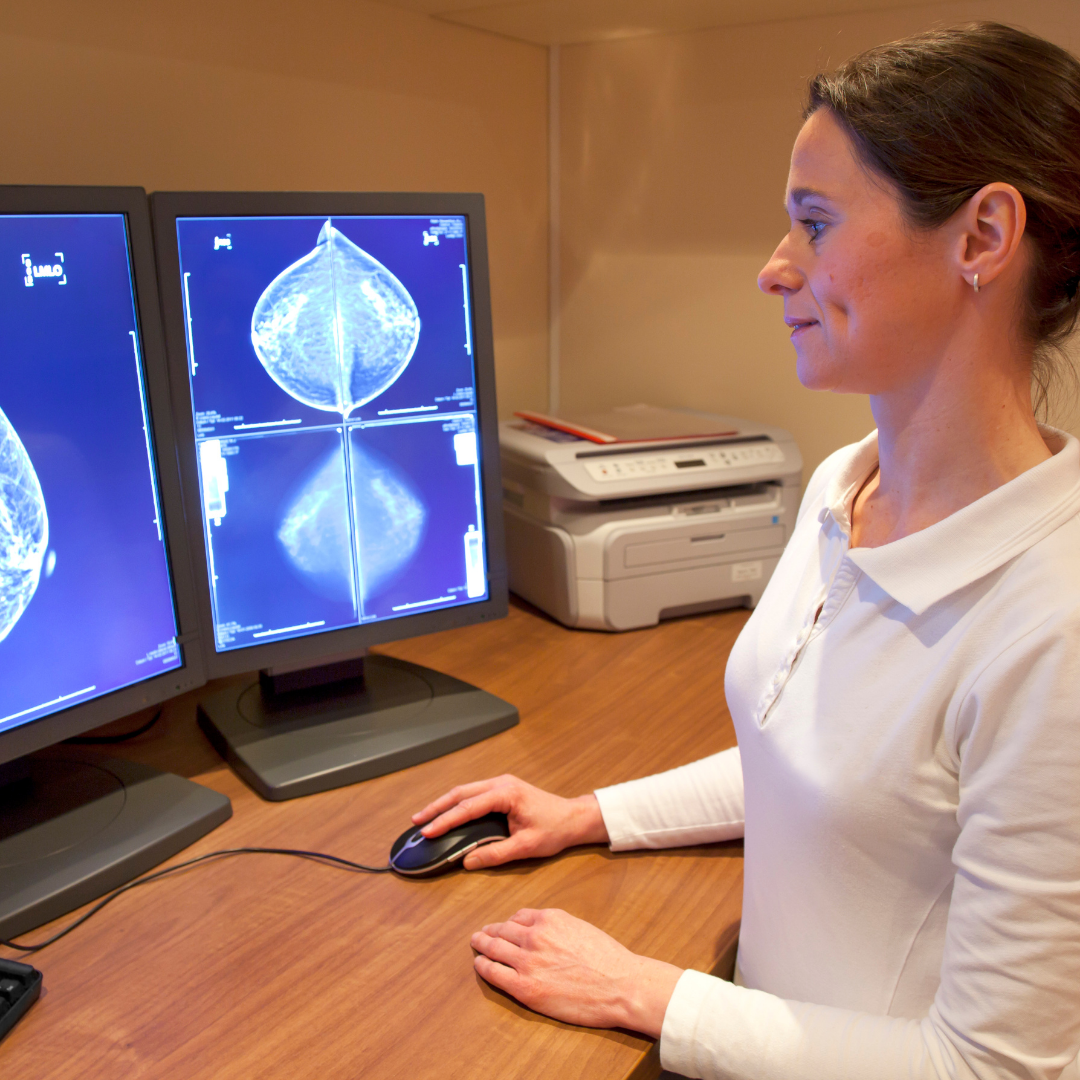 Reasonable Expectations - Mammography Educators