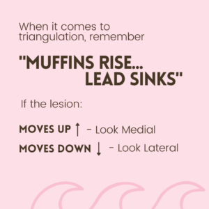 POSITIONING DYNAMITE… TNT Part 2: Triangulation – Mammography Educators