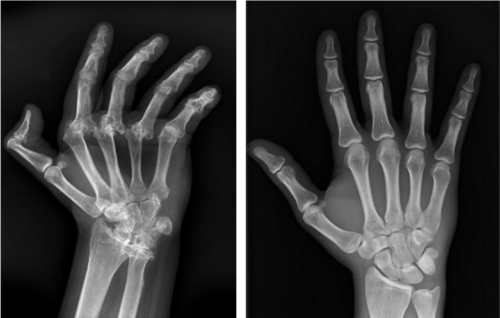 Challenging Patients & Situations Part 1: Positioning Tips ...