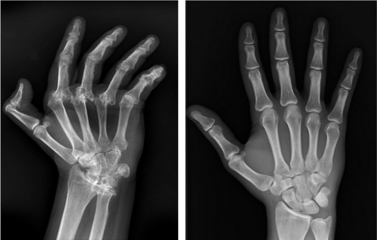 Challenging Patients & Situations Part 1: Positioning Tips ...