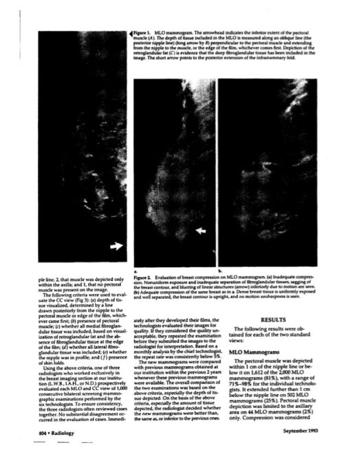 Mammography Positioning: Evaluation from the View Box – Mammography ...