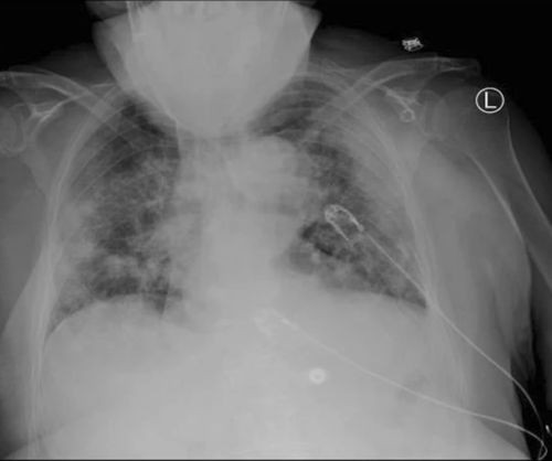 Challenging Patients & Situations Part 1: Positioning Tips ...