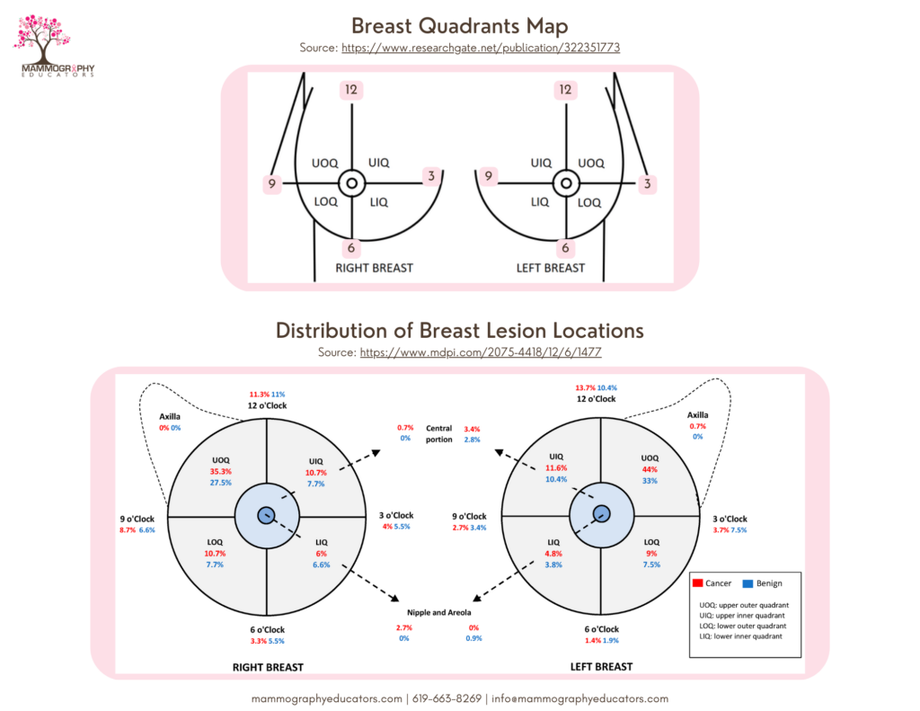 Breast Quadrant Map And Distribution Of Breast Lesion Locations Breast Quadrant Map And Distribution Of Breast Lesion Locations