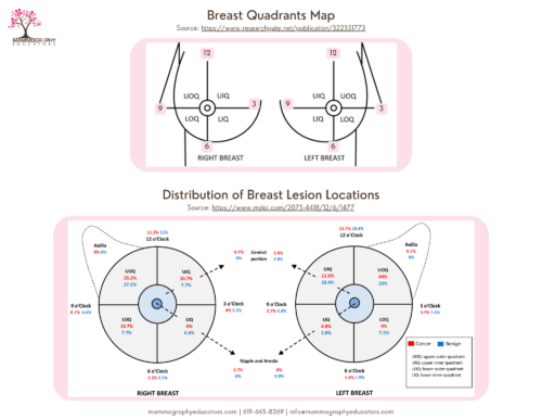 Breast Quadrant Map and Distribution of Breast Lesion Locations – Mammography Educators