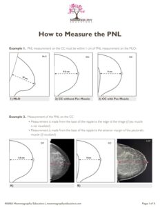 How To Properly Measure the PNL – Mammography Educators