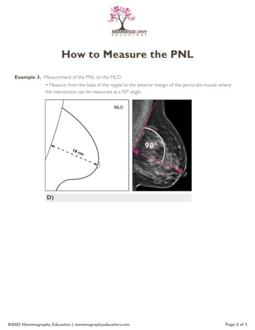 How To Properly Measure the PNL – Mammography Educators