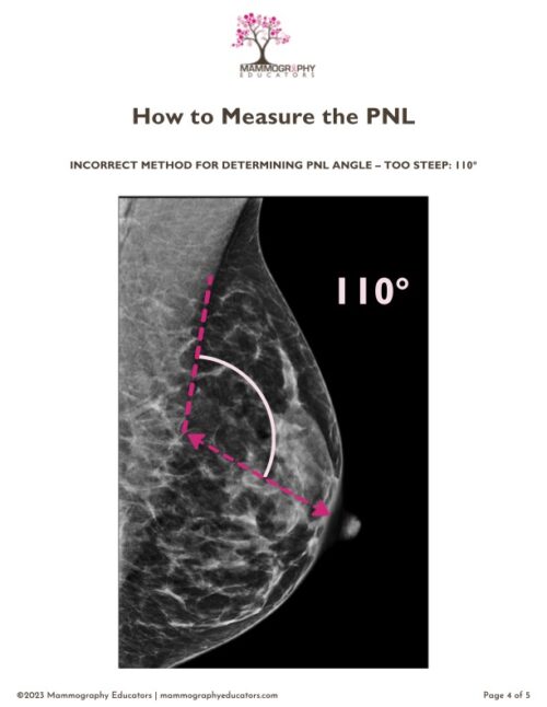 How To Properly Measure the PNL – Mammography Educators
