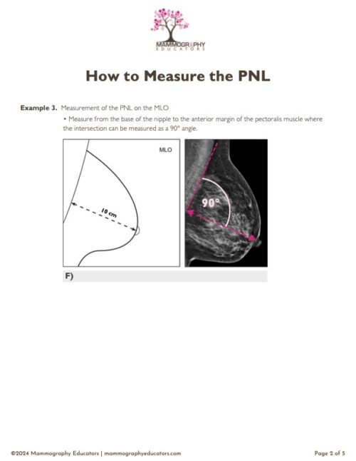 How To Properly Measure the PNL – Mammography Educators